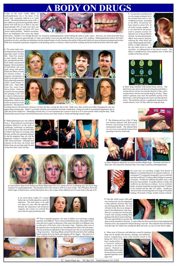A Body on Drugs Wall Chart – Amera-Chem, Inc./Drug Identification Bible